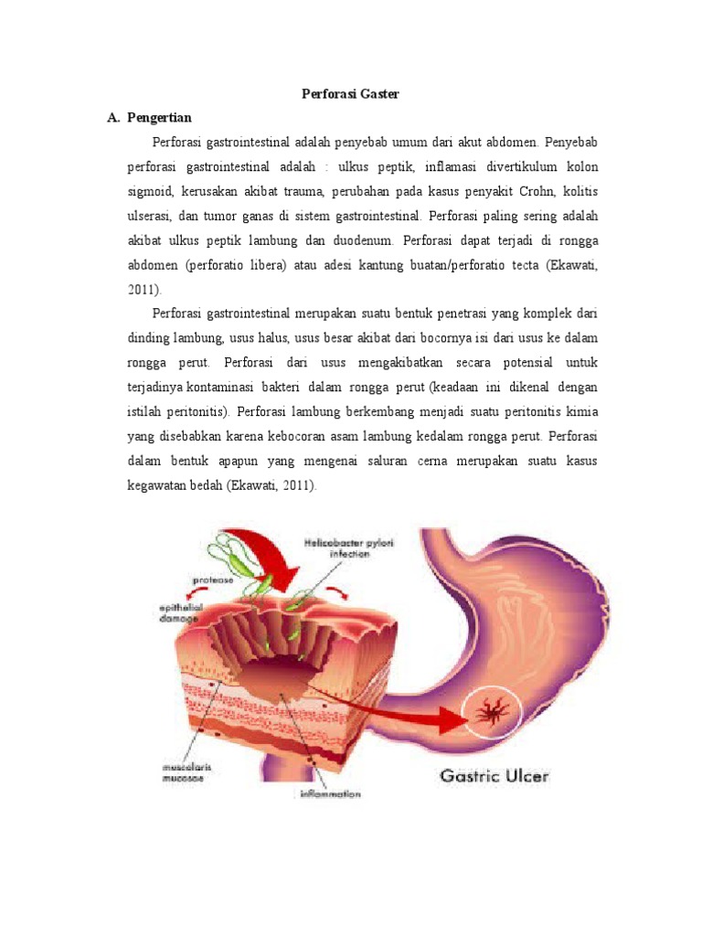 LP Perforasi Gaster | PDF