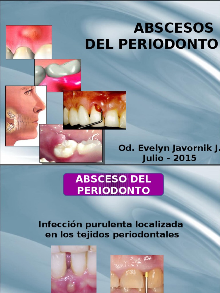 Clase Absceso Periodontal | PDF | Diente humano | Odontología