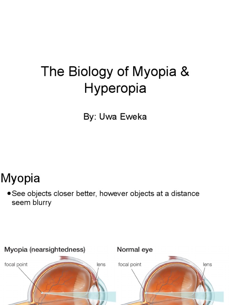 The Biology of Myopia & Hyperopia | PDF