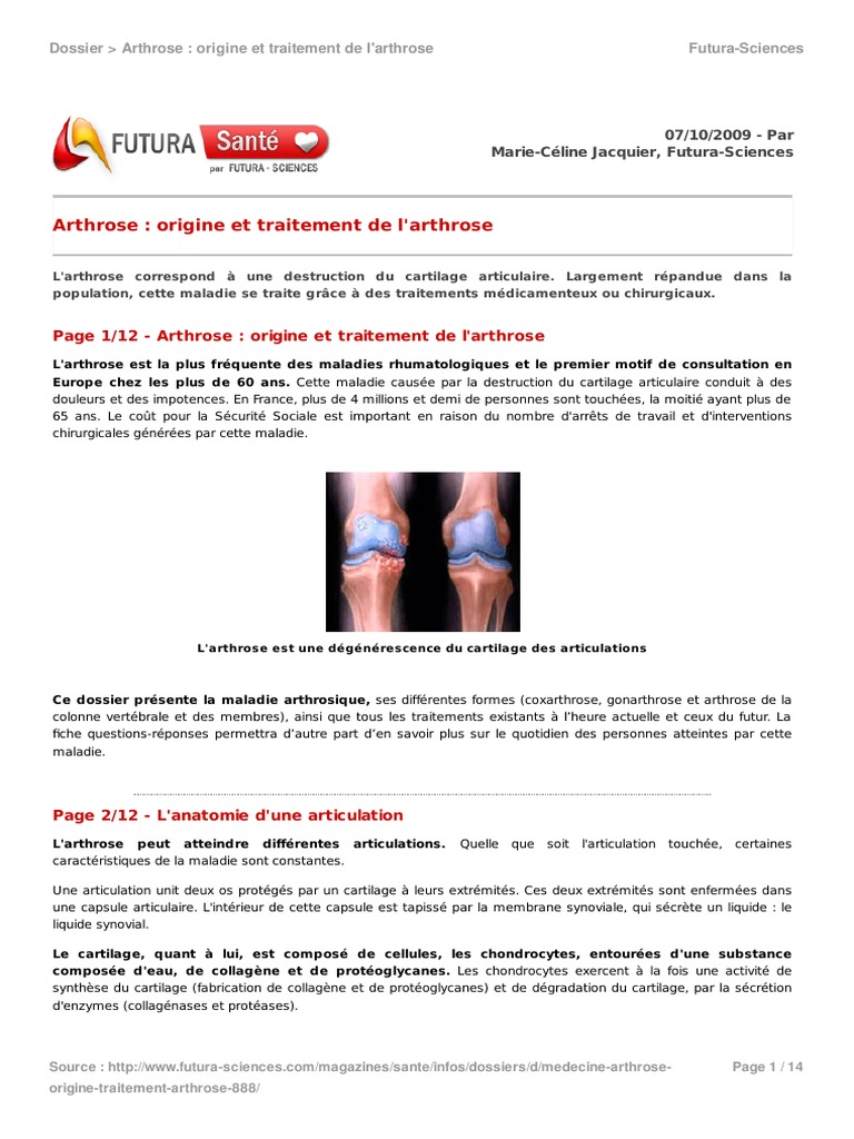 888 Arthrose Origine Traitement Arthrose | PDF | Arthrose | Genou