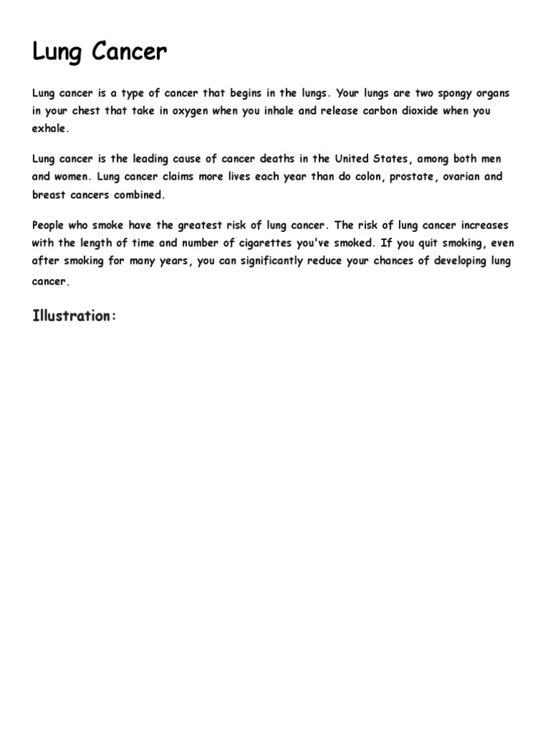 Lung Cancer | PDF | Lung Cancer | Non Small Cell Lung Carcinoma