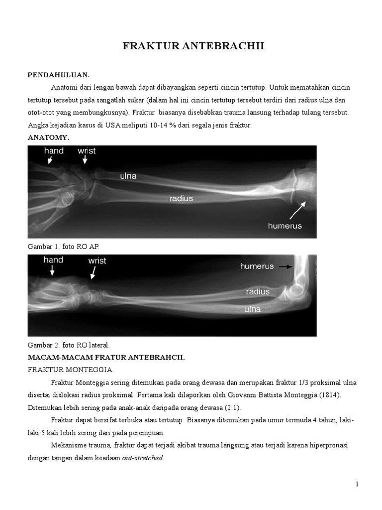 Fraktur Antebrachii | PDF