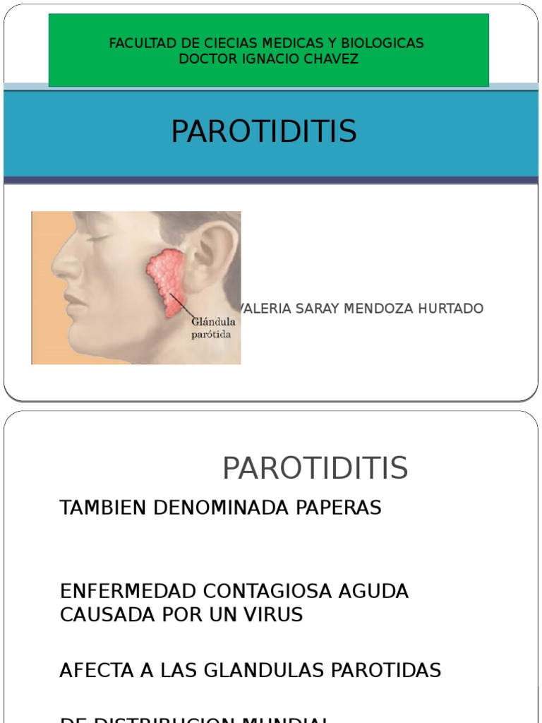 Parotiditis | PDF