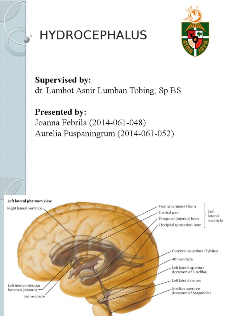 Hydrocephalus Teori Final | PDF | Cerebrospinal Fluid | Neurological ...