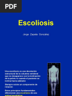 Signo de Risser | PDF | Escoliosis | Rtt