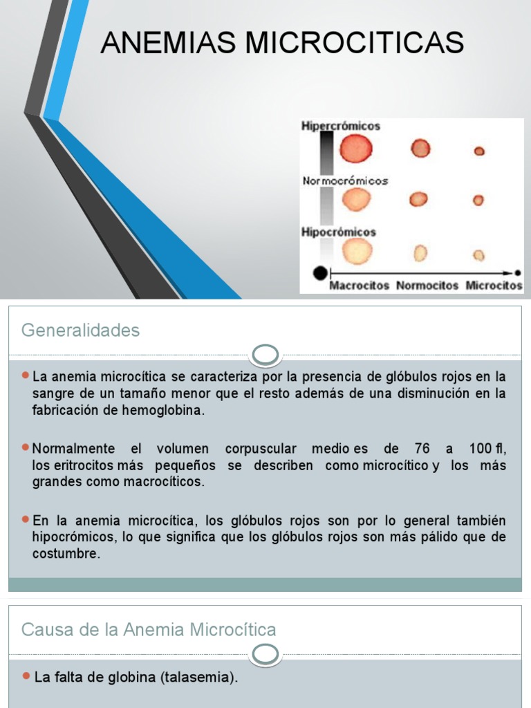 Anemias Microcíticas | PDF | Anemia | Medicina