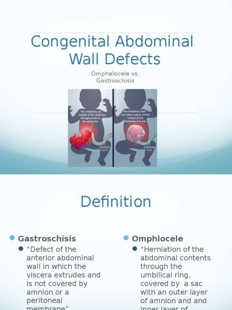 Abdominal Wall Defects | Medicine | Medical Specialties