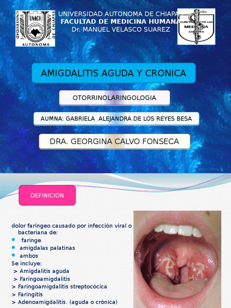 Amigdalitis Aguda y Cronica | PDF | Otorrinolaringología | Estreptococo
