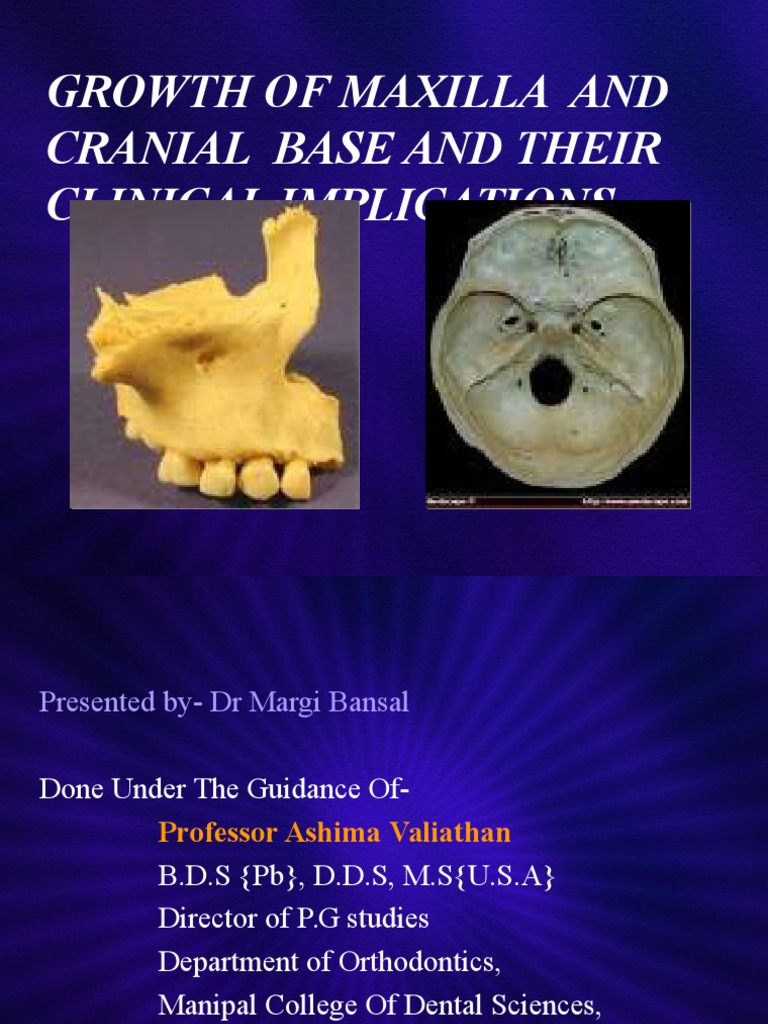 Growth of Maxilla | Skull | Human Head And Neck