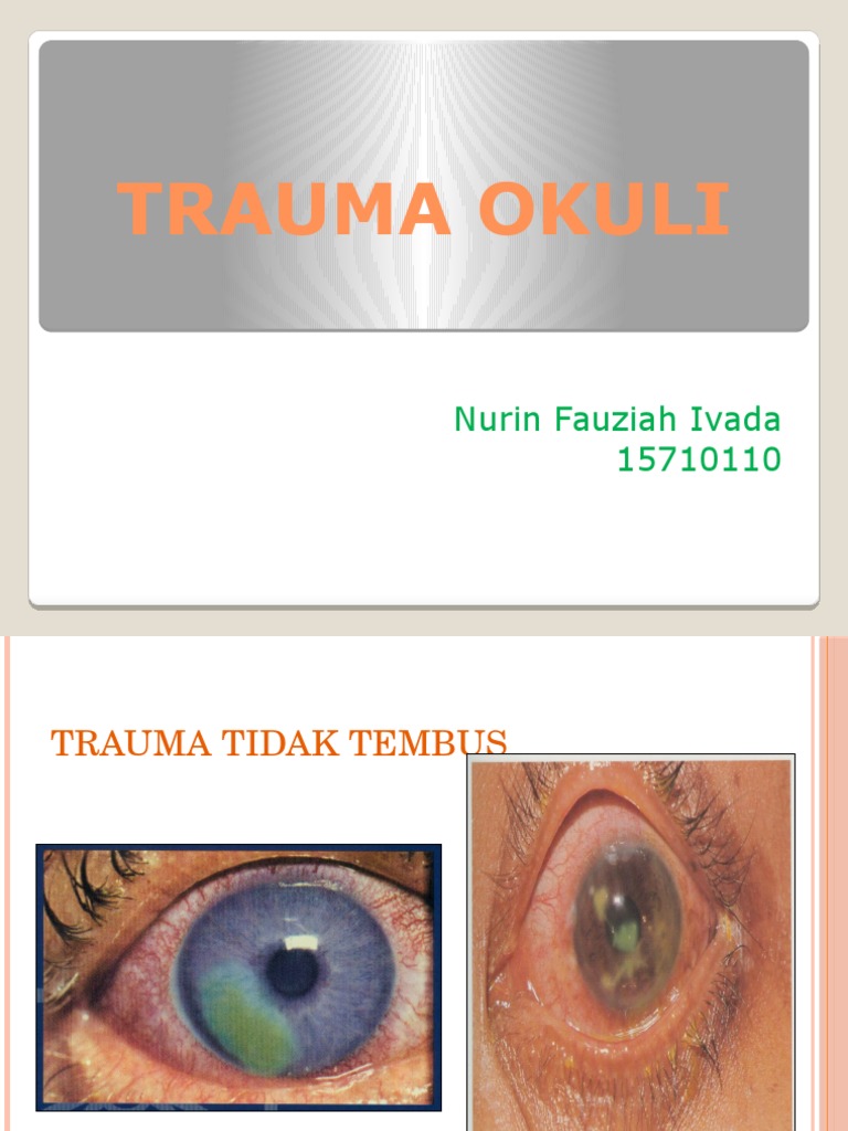 Types of Ocular Trauma Explained | PDF | Ophthalmology | Diseases Of ...