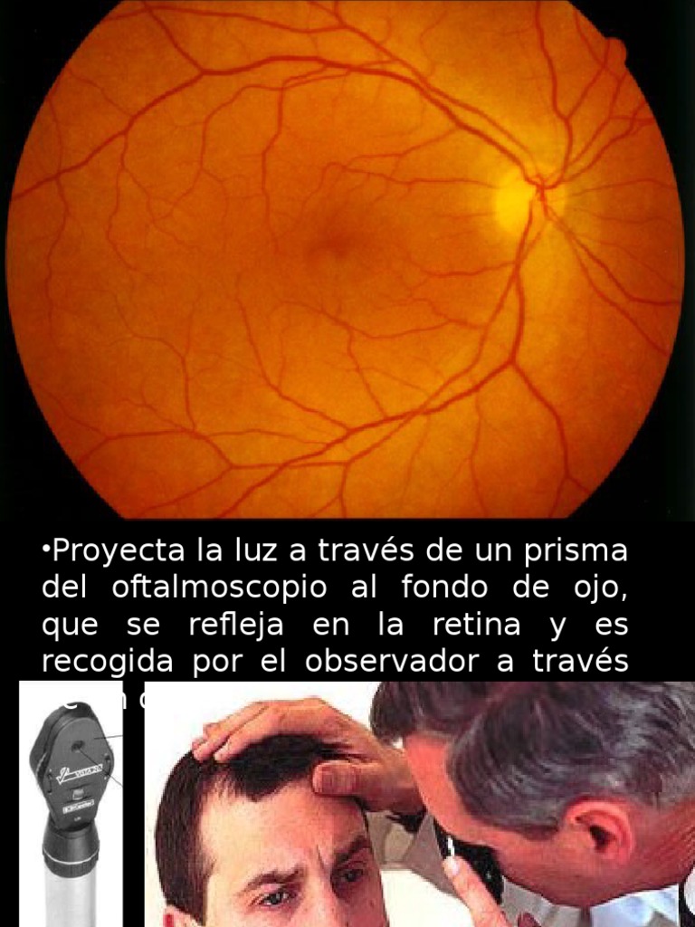 Fondo de Ojo Normal | Ojo humano | Sistema visual