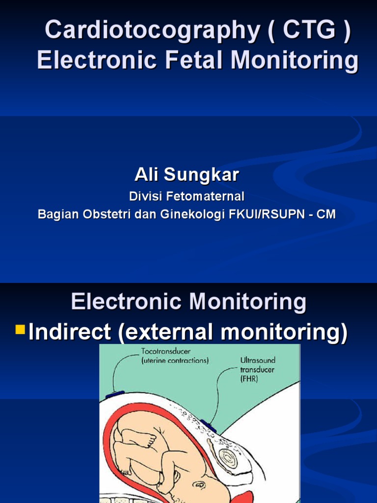 Panduan Lengkap Cardiotocography (CTG) | PDF
