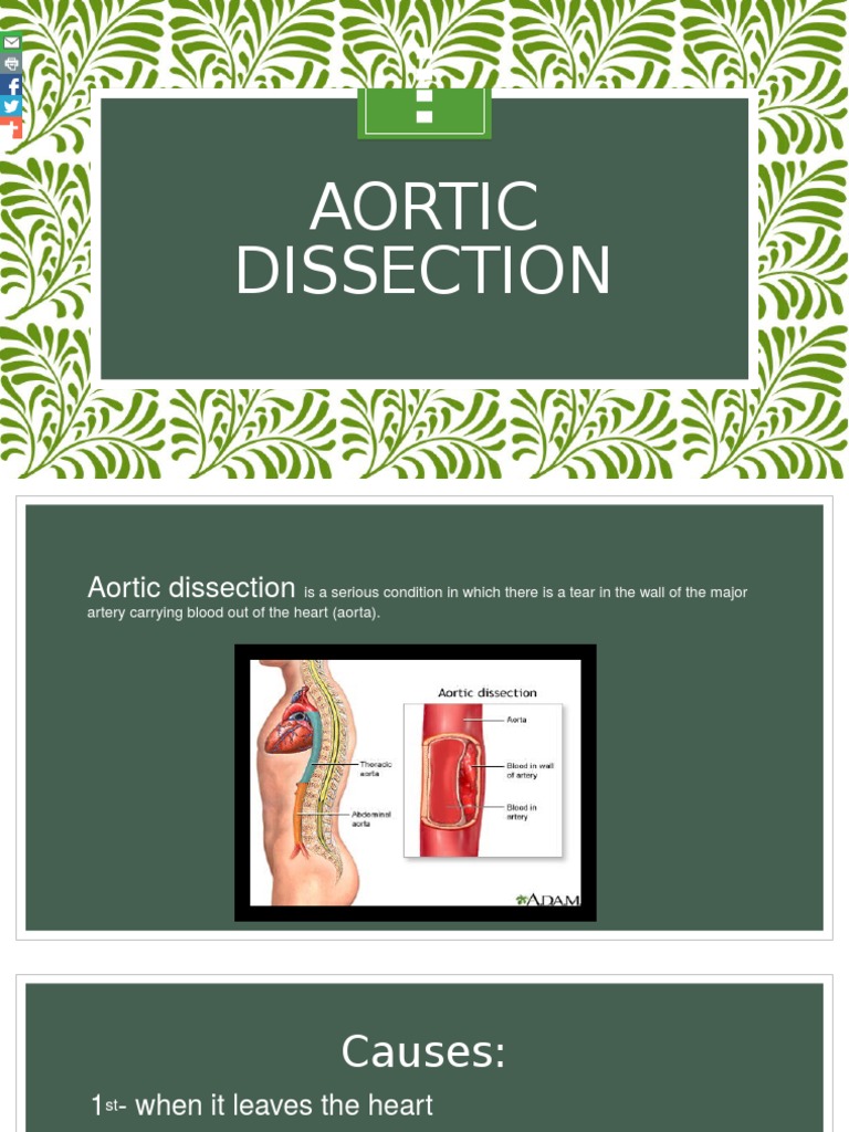 AORTIC Dissection | PDF | Aorta | Medical Specialties