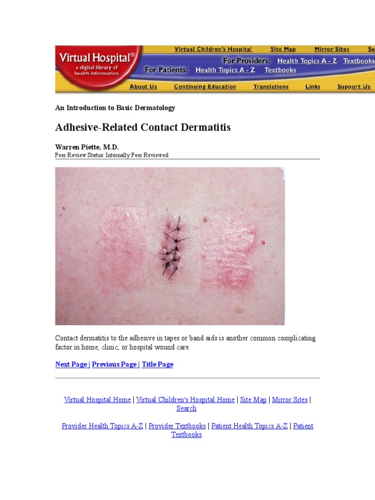 Adhesive Contact Dermatitis | PDF