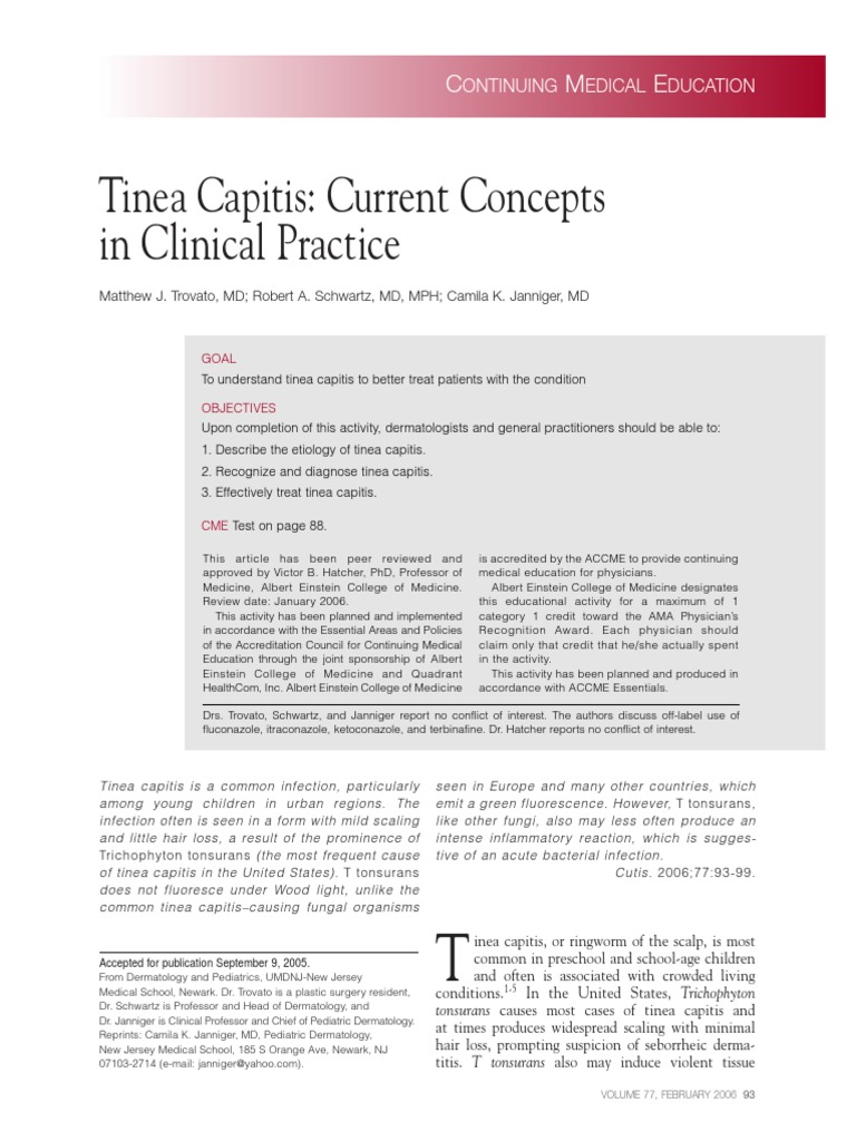 Tinea Capitis | Hair Loss | Clinical Medicine