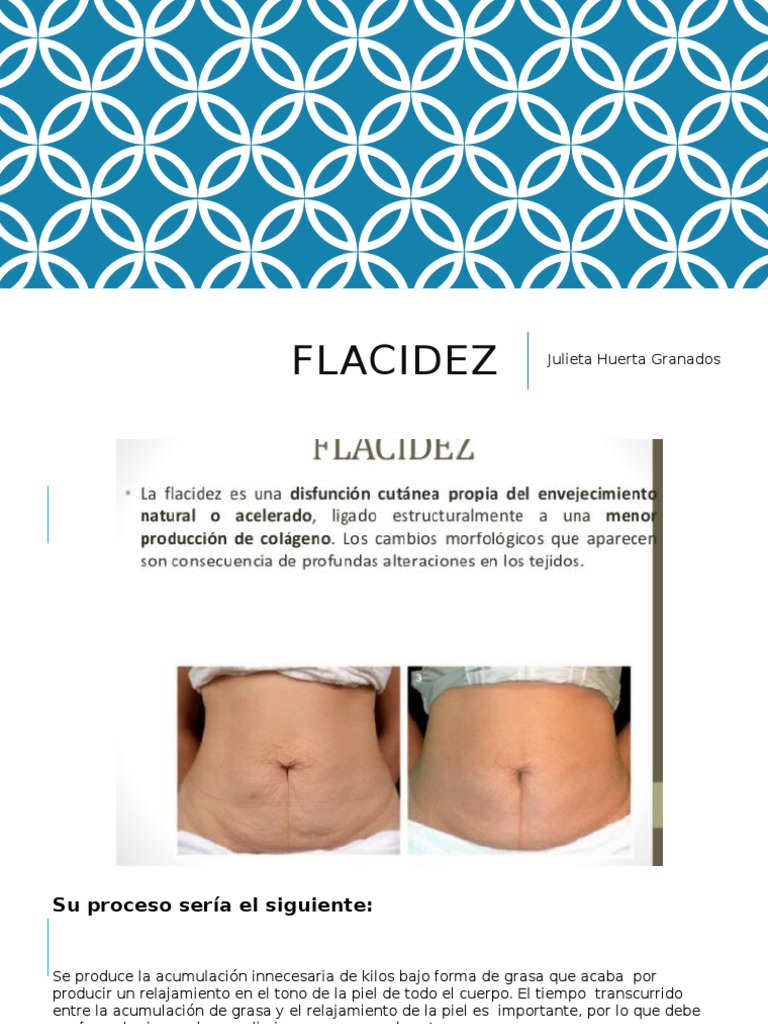 Tipos y Tratamientos de Flacidez | PDF | Piel | Tejido adiposo