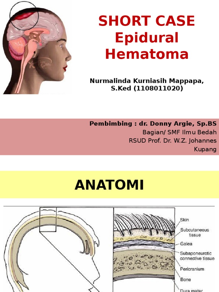 SHORT CASE 1 Epidural Hematoma | PDF | Traumatic Brain Injury | Accidents
