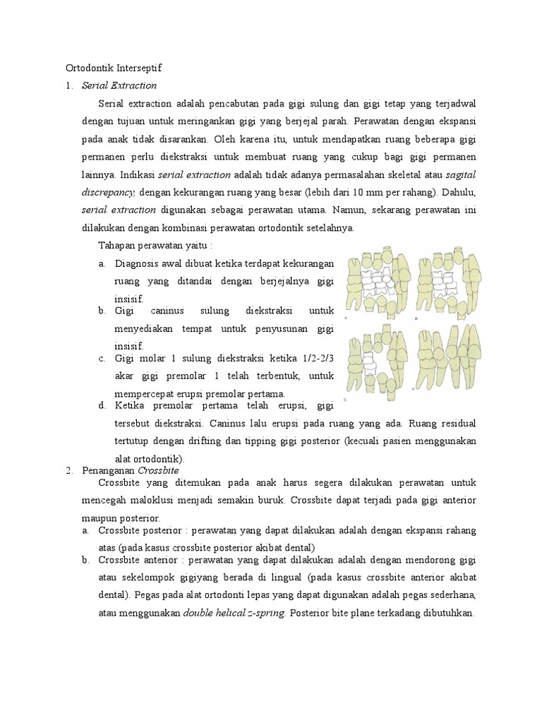 Serial Extraction dalam Ortodontik Anak | PDF