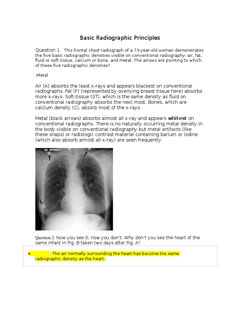 Basic Radiographic Principles | PDF | Lung | Lung Cancer