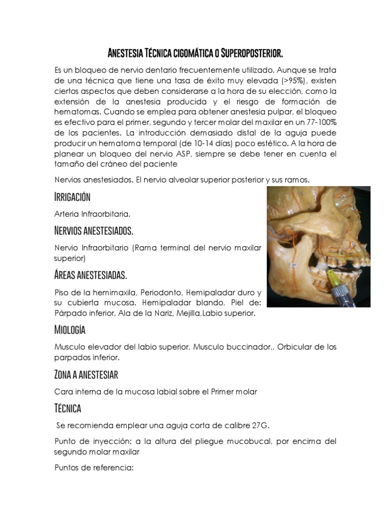 Tecnica Cigomatica | PDF | Anatomía humana | Cabeza y cuello humanos