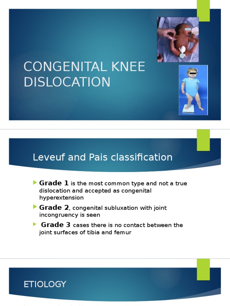 Congenital Knee Dislocation | PDF