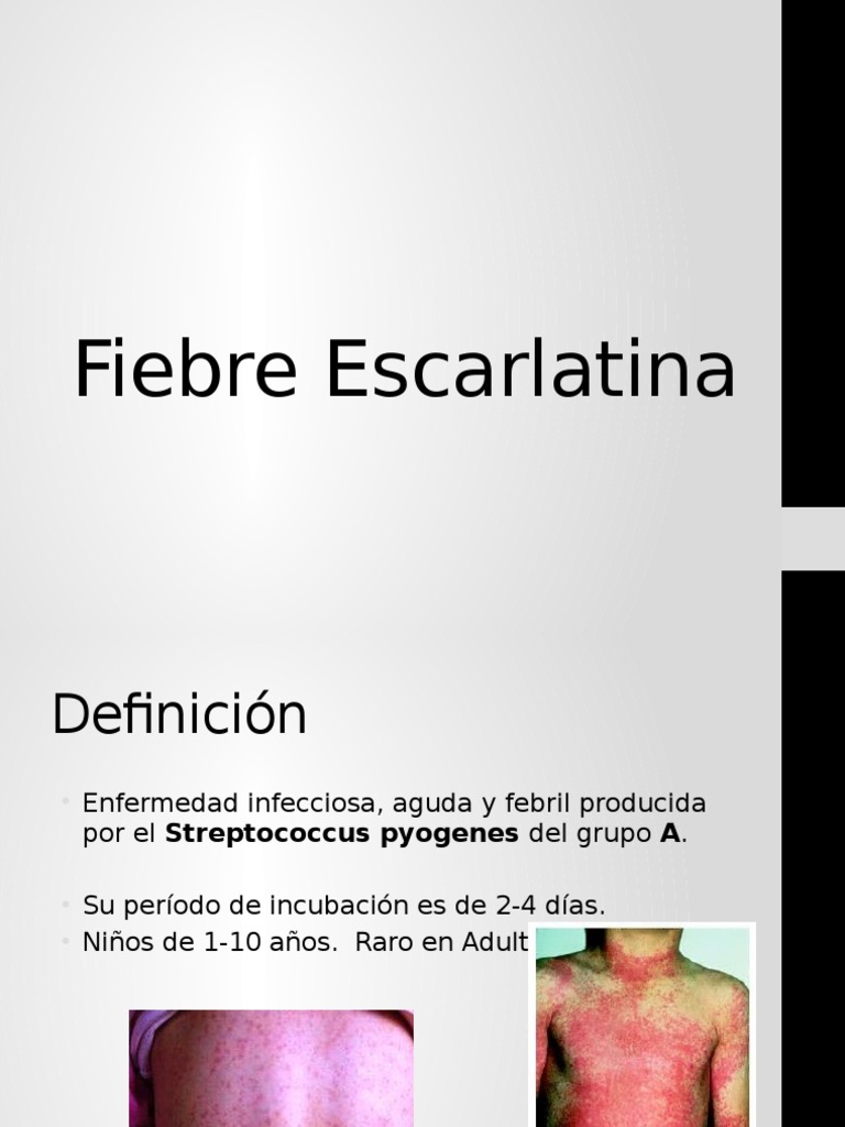 Fiebre Escarlatina | Immunology | Public Health