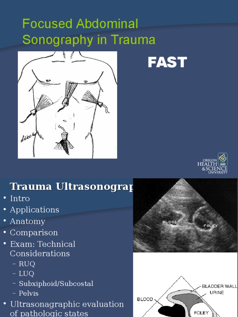 FAST-Exam | Major Trauma | Medical Ultrasound