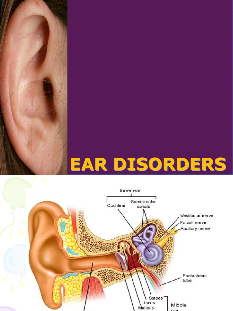 The Ear and It's Disorders | PDF