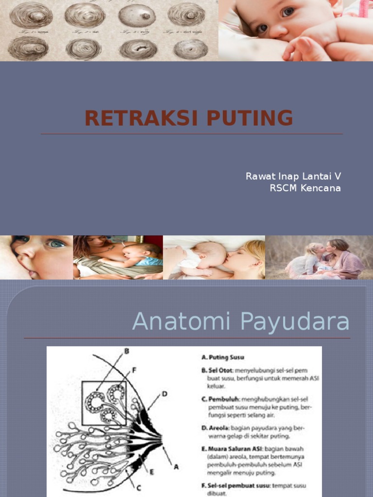 Retraksi Puting | PDF