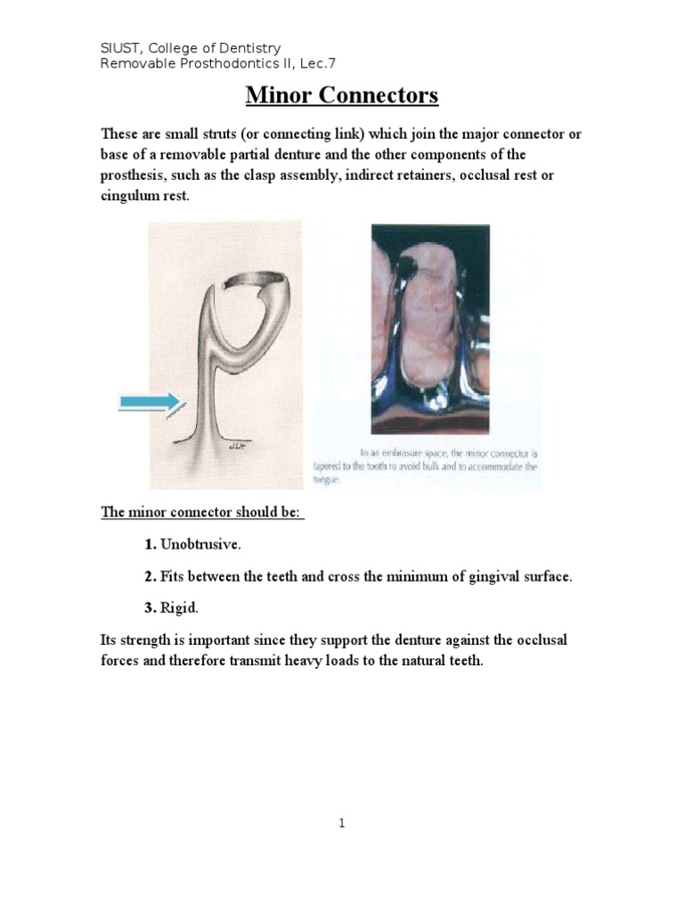 Removable Prosthodontics II - Lec.7, Minor Connectors - SIUST, College ...