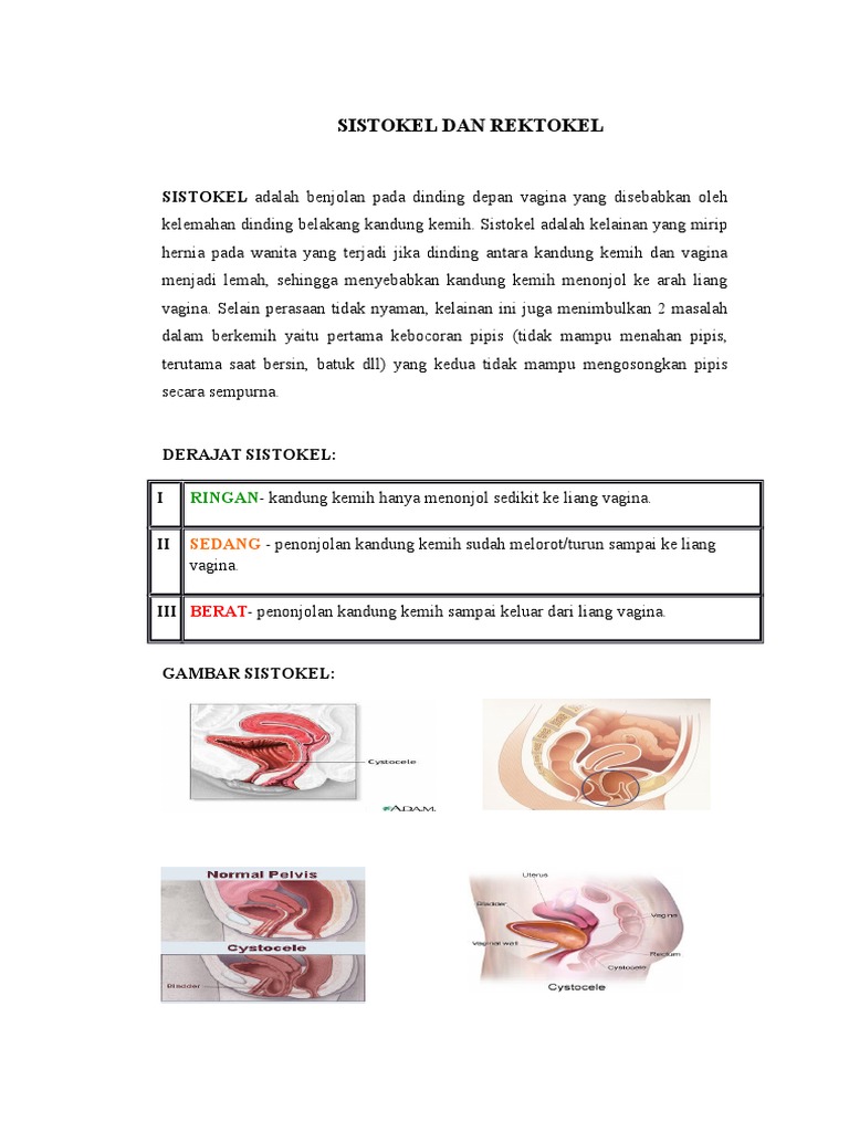 Sistokel Dan Rektokel JD | PDF