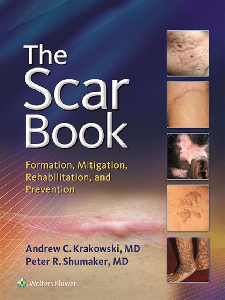 The Scar Book Formation Mitigation Rehabilitation and Prevention | PDF ...
