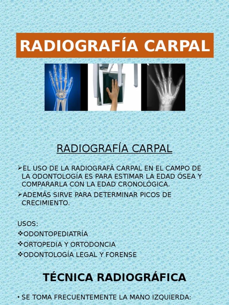Radiografía Carpal Pptx