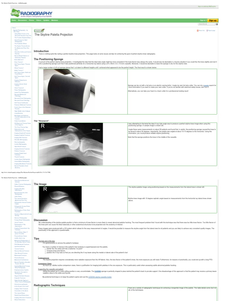 The Skyline Patella Projection | Knee | Radiography