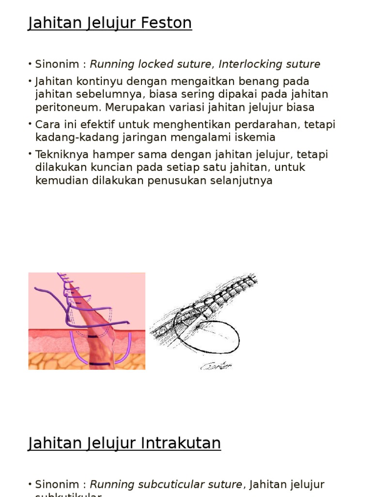 Bahan Css Jenis Jahitan | PDF | Sains & Matematika