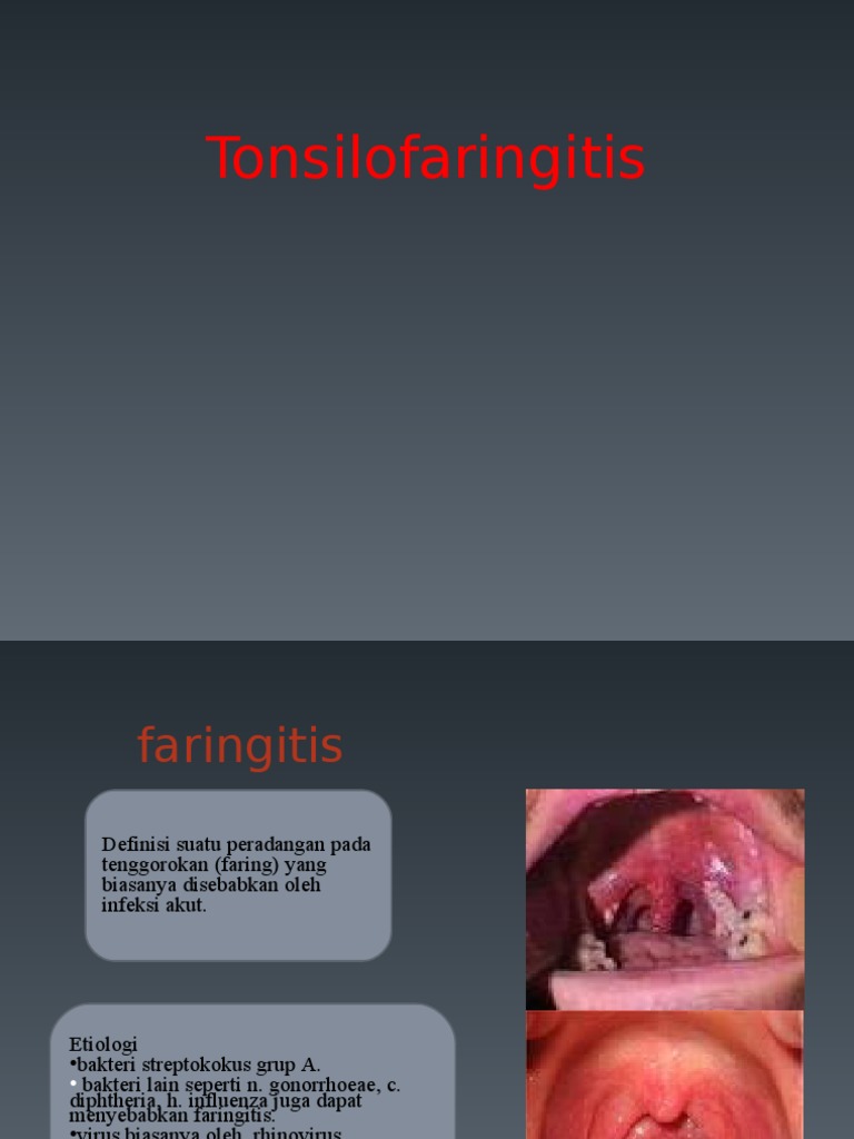 TONSILOFARINGITIS: PENYAKIT PERADANGAN TONSIL DAN FARING | PDF