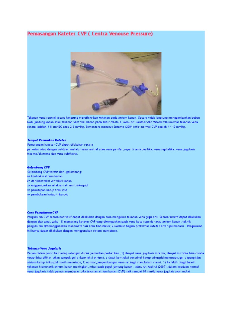Pemasangan Kateter CVP | PDF