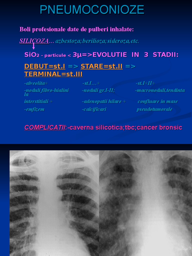 Plamani Radiologie | PDF