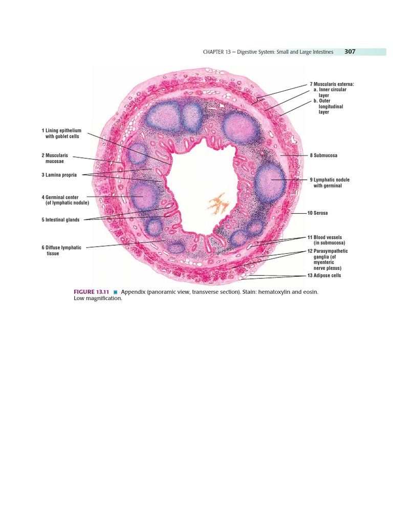 Histology of Appendix | PDF | Gastrointestinal Tract | Organ (Anatomy)