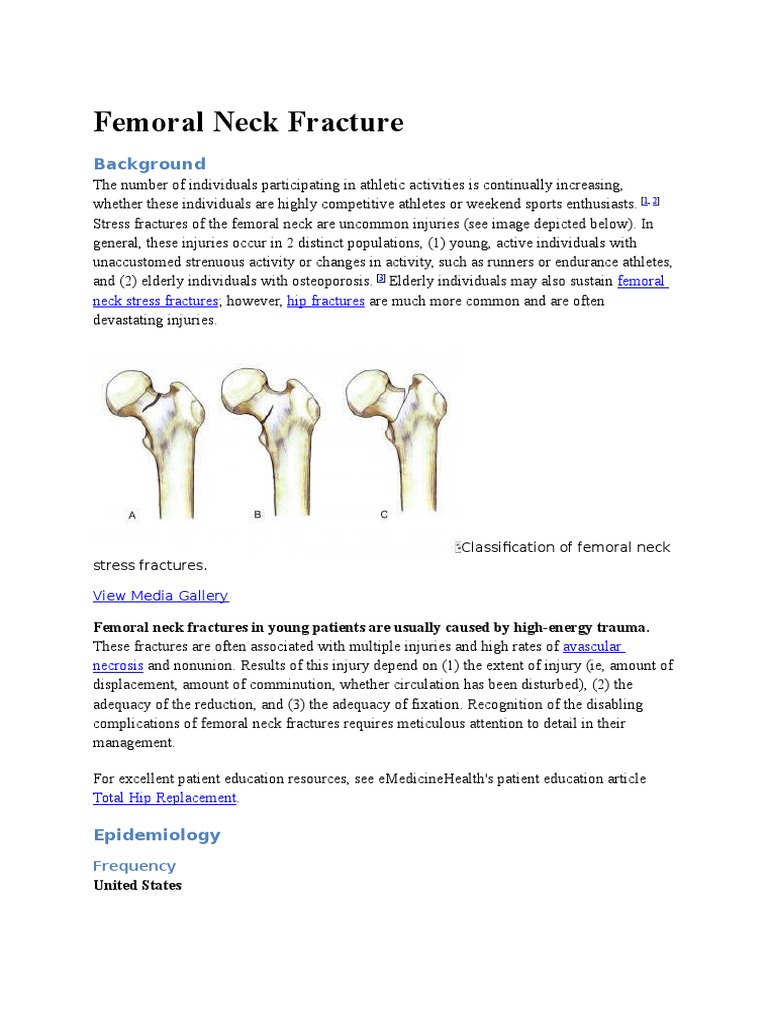 Femoral Neck Fracture | Hip | Analgesic