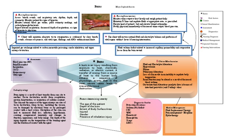 BURNS Concept Map | Burn | Hypoxia (Medical)