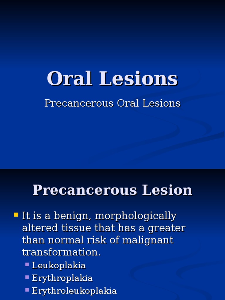 Premalignant Oral Lesions | PDF | Epithelium | Anatomy