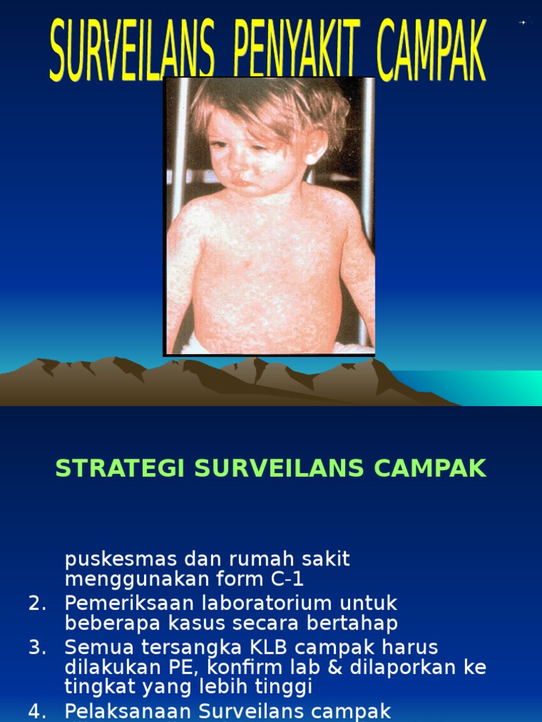Surveilans Campak | PDF