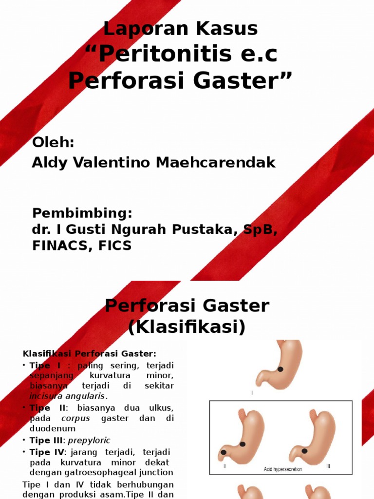 Laporan Kasus Perforasi Gaster | PDF