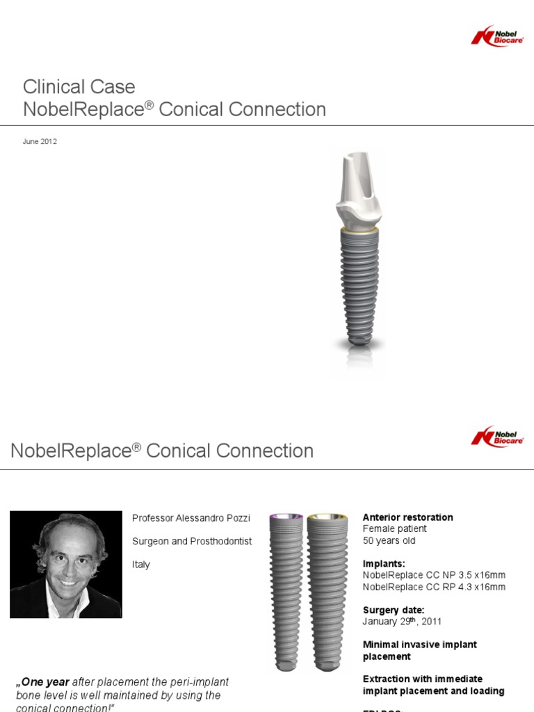 Clinical Case NobelReplace Conical Connection Alessandro Pozzi | PDF ...