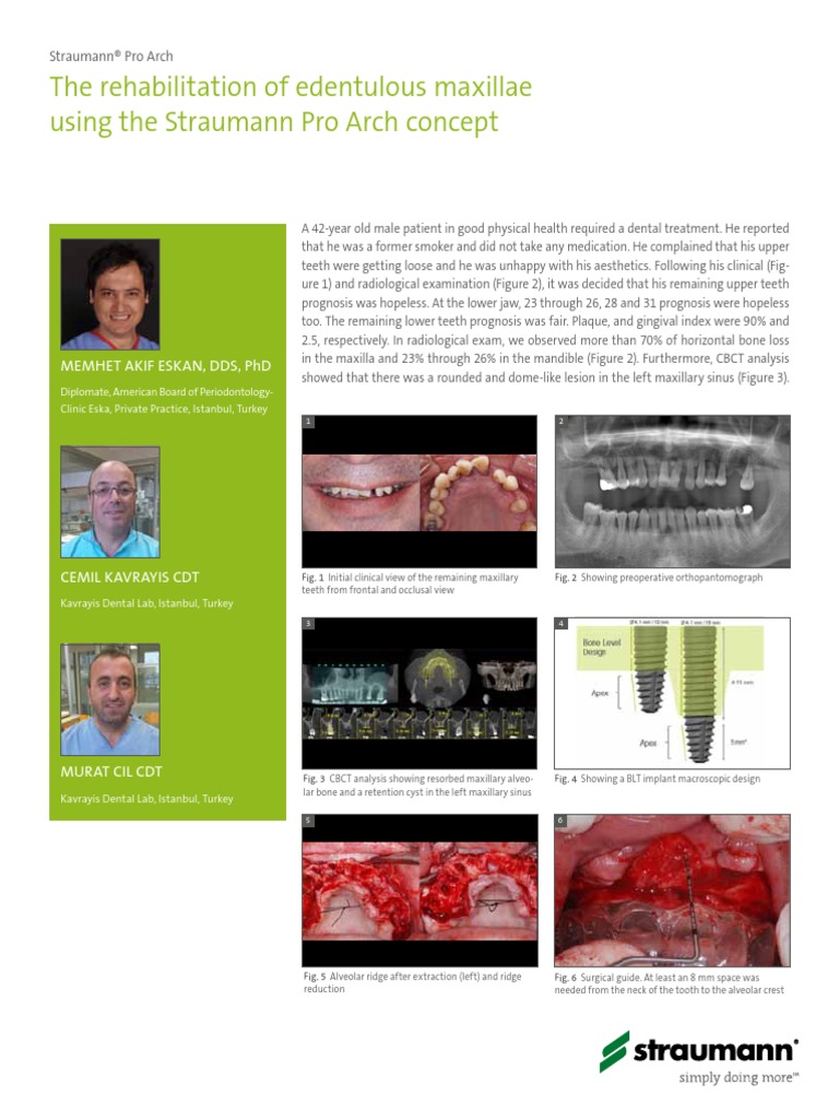 Straumann Pro Arch DR Eskan | PDF | Dental Implant | Surgery
