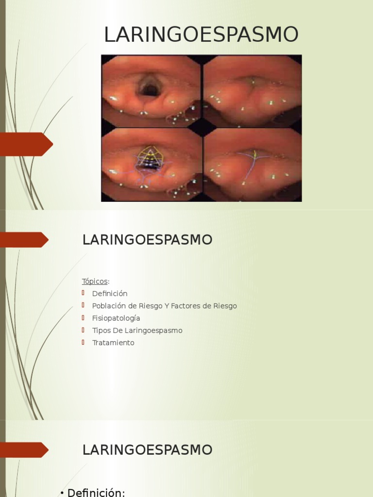 Presentacion LARINGOESPASMO | Especialidades Medicas | Medicina CLINICA