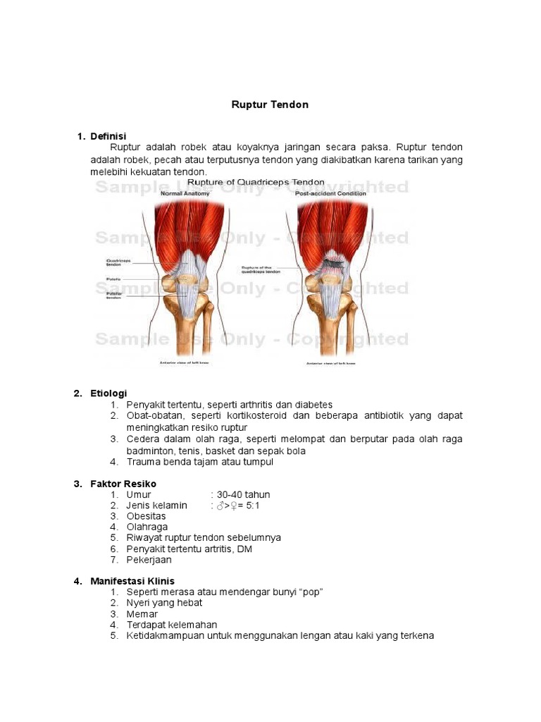 LP Ruptur Tendon | PDF