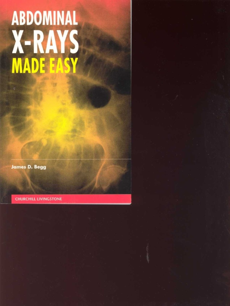 Abdominal X-Rays Made Easy PDF | PDF