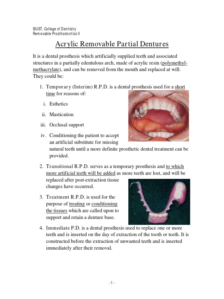 Removable Prosthodontics II - Acrylic Removable Partial Dentures ...